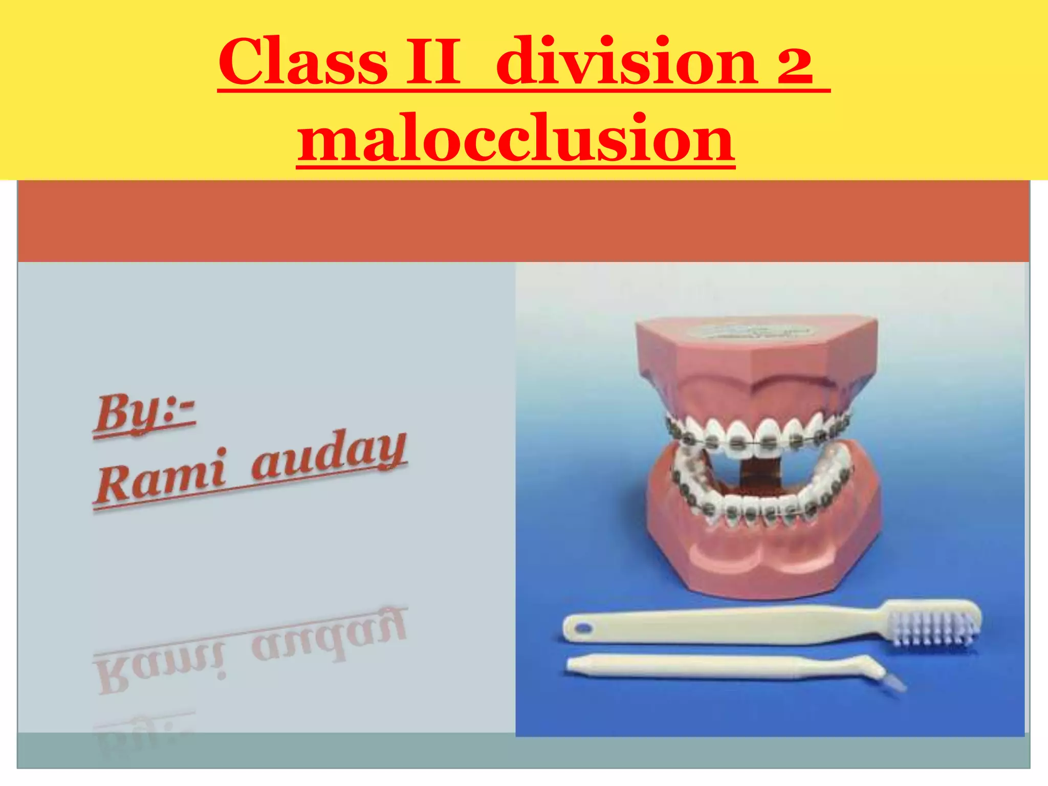 class ii division 2 malocclusion | PPTX