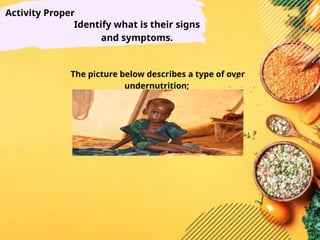 Characteristics sign and symptoms of malnutrition. | PPTX