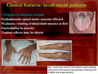 Clin Neuro Mnd Davidson06. | PPT | Physical Therapy | Wellness