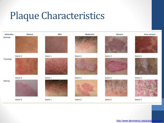 A Clinical and Technical Assessment of Biologics for Moderate-to-Sev…