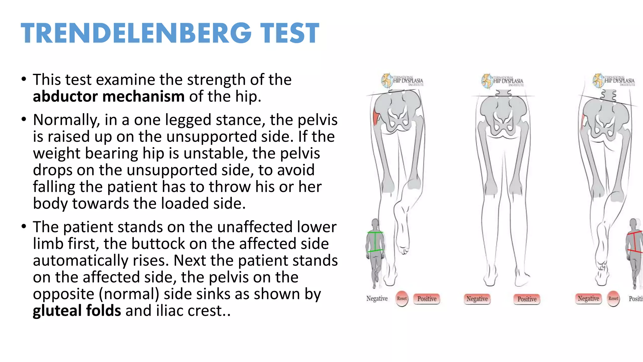Clinical examination of hip | PPTX