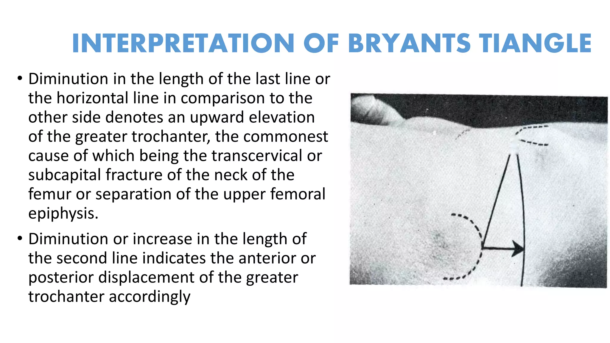 Clinical examination of hip | PPTX