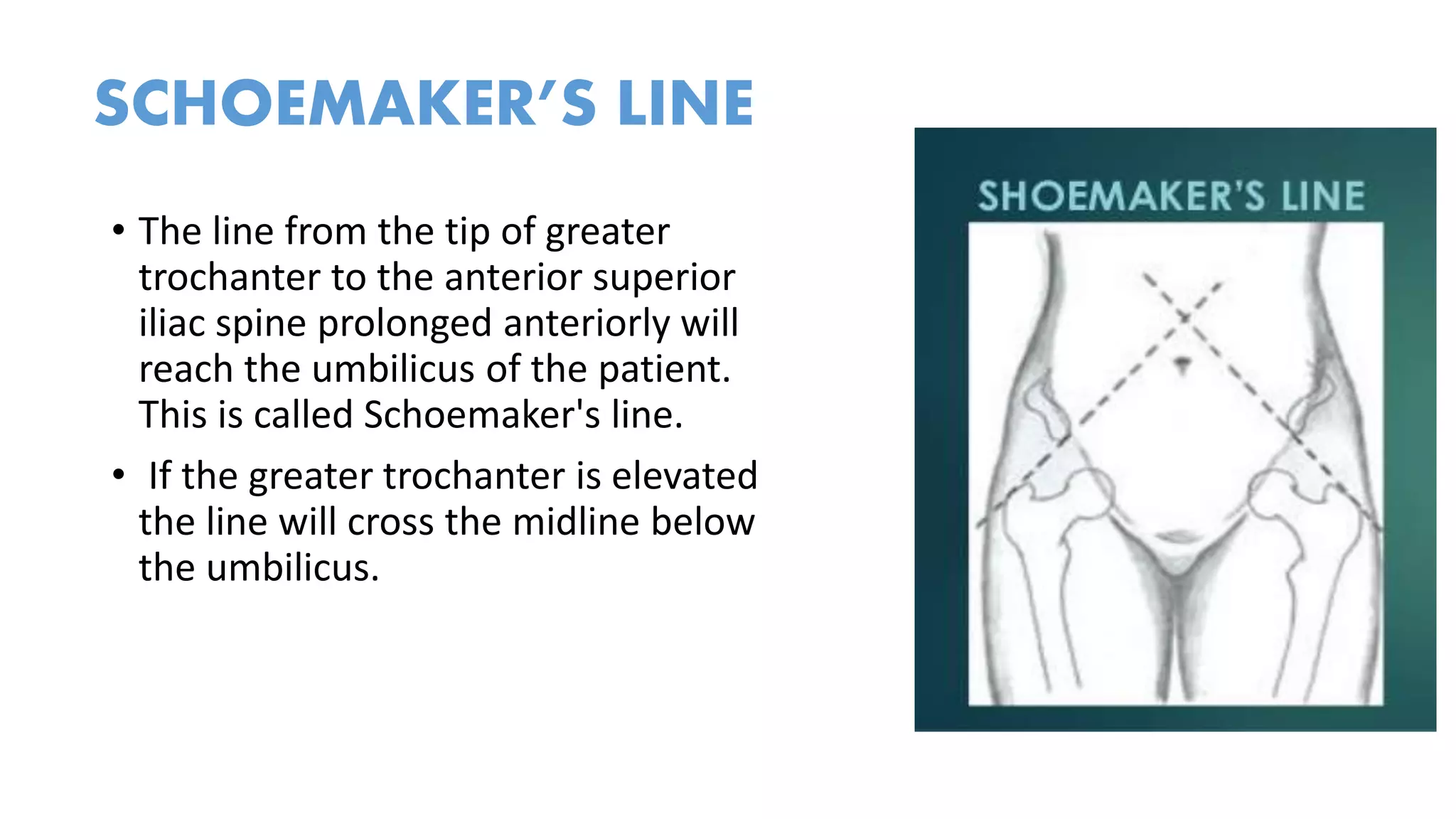 Clinical examination of hip | PPTX