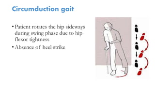 Clinical examination of hip | PPTX