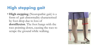 Clinical examination of hip | PPTX