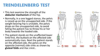 Clinical examination of hip | PPTX