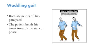 Clinical examination of hip | PPTX