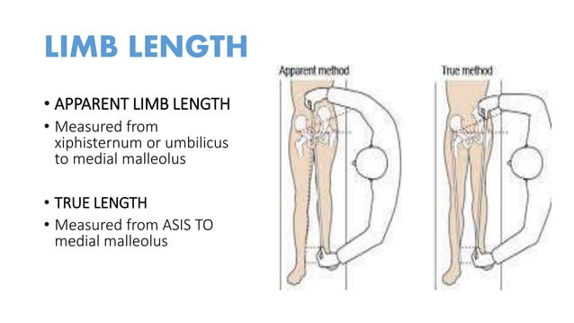 Clinical examination of hip