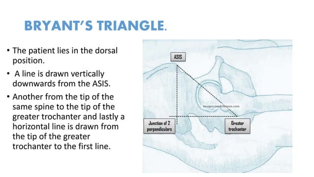 Clinical examination of hip