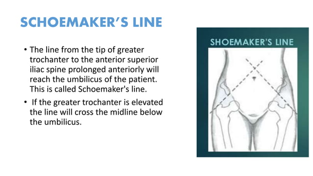 Clinical examination of hip