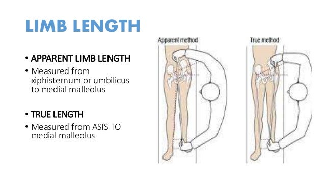 Clinical examination of hip