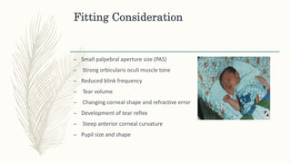 Pediatric Contact lens | PPTX | Eye and Vision Conditions | Diseases ...