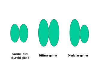 Clinical Diagnosis of Thyroid Disorders | PPT