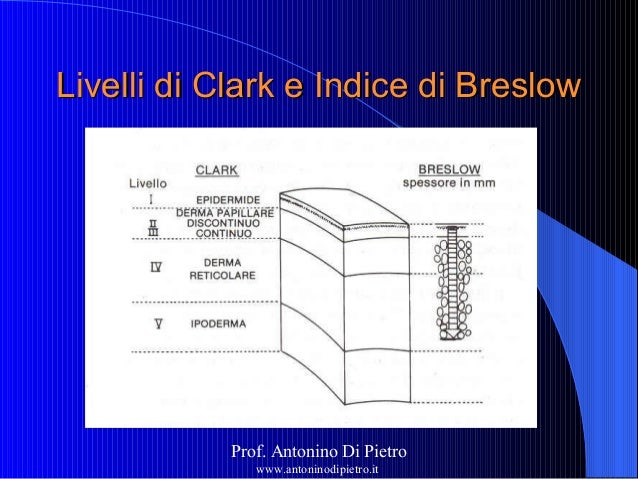 Il melanoma cutaneo: dalla clinica alla terapia