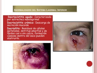Glandula lagrimal | PPTX