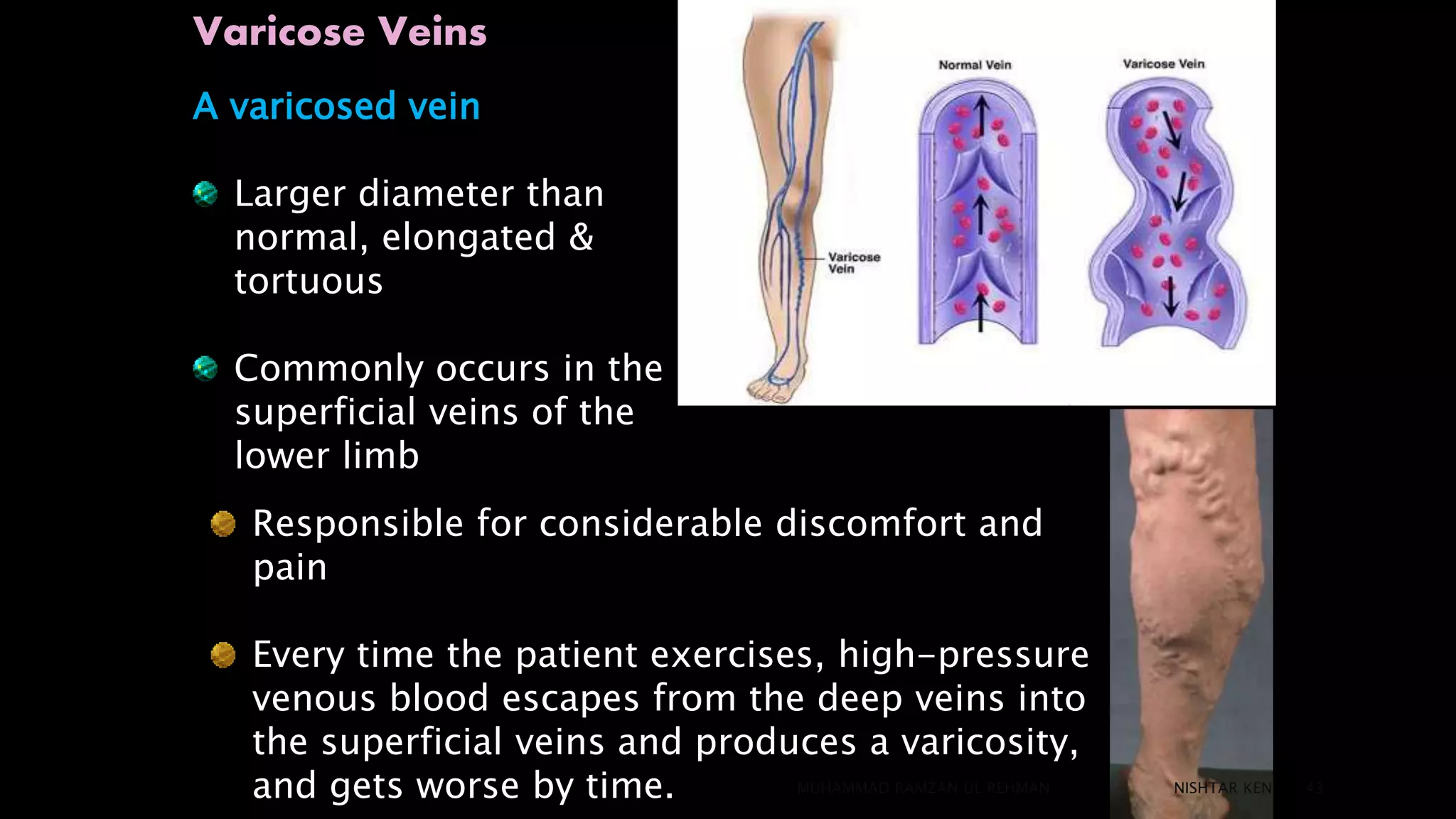 clinical-anatomy-of-the-lower-limb-140902094941-phpapp01.pdf