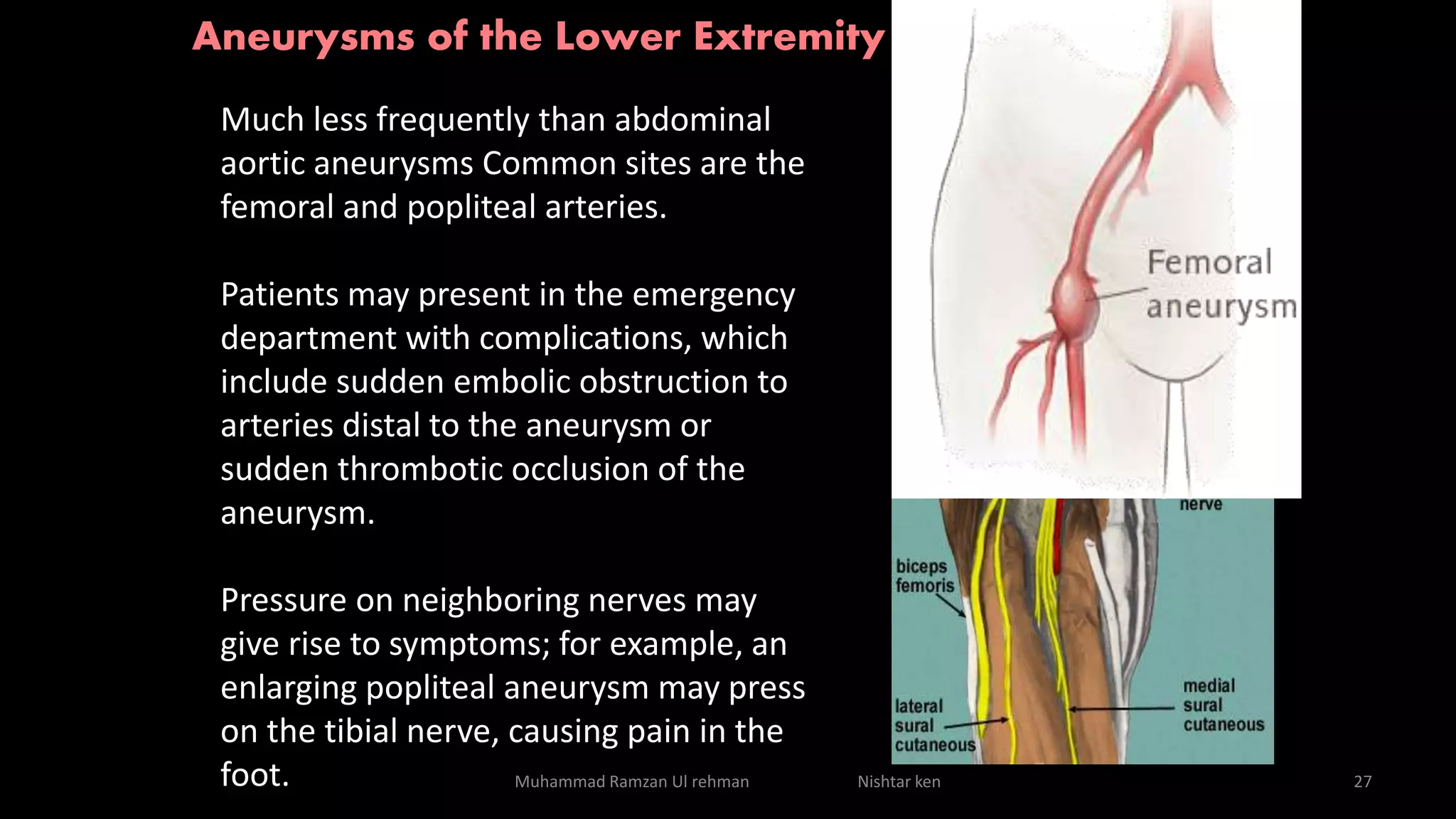 Clinical anatomy of the lower limb | PPTX