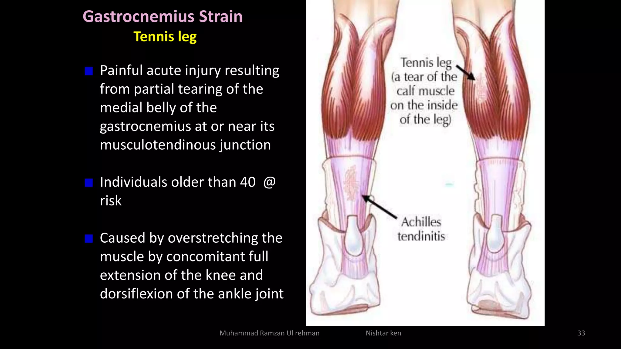 Clinical anatomy of the lower limb | PPTX