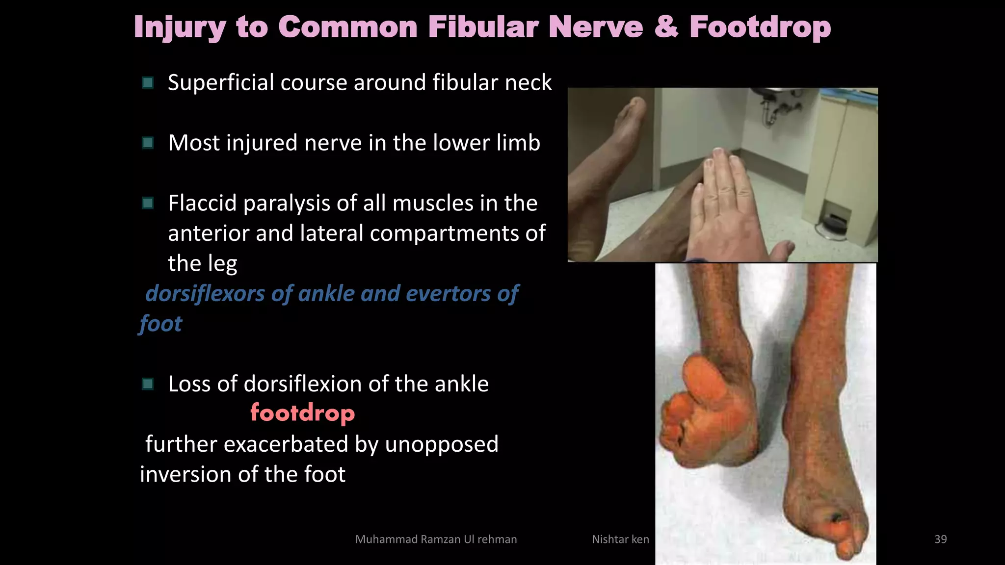 Clinical anatomy of the lower limb | PPTX