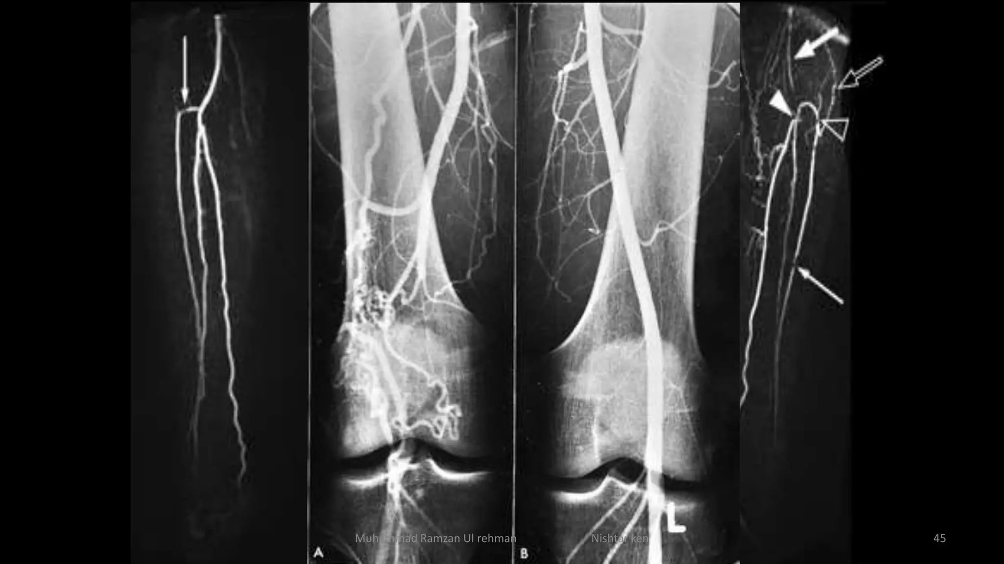 Clinical anatomy of the lower limb | PPTX