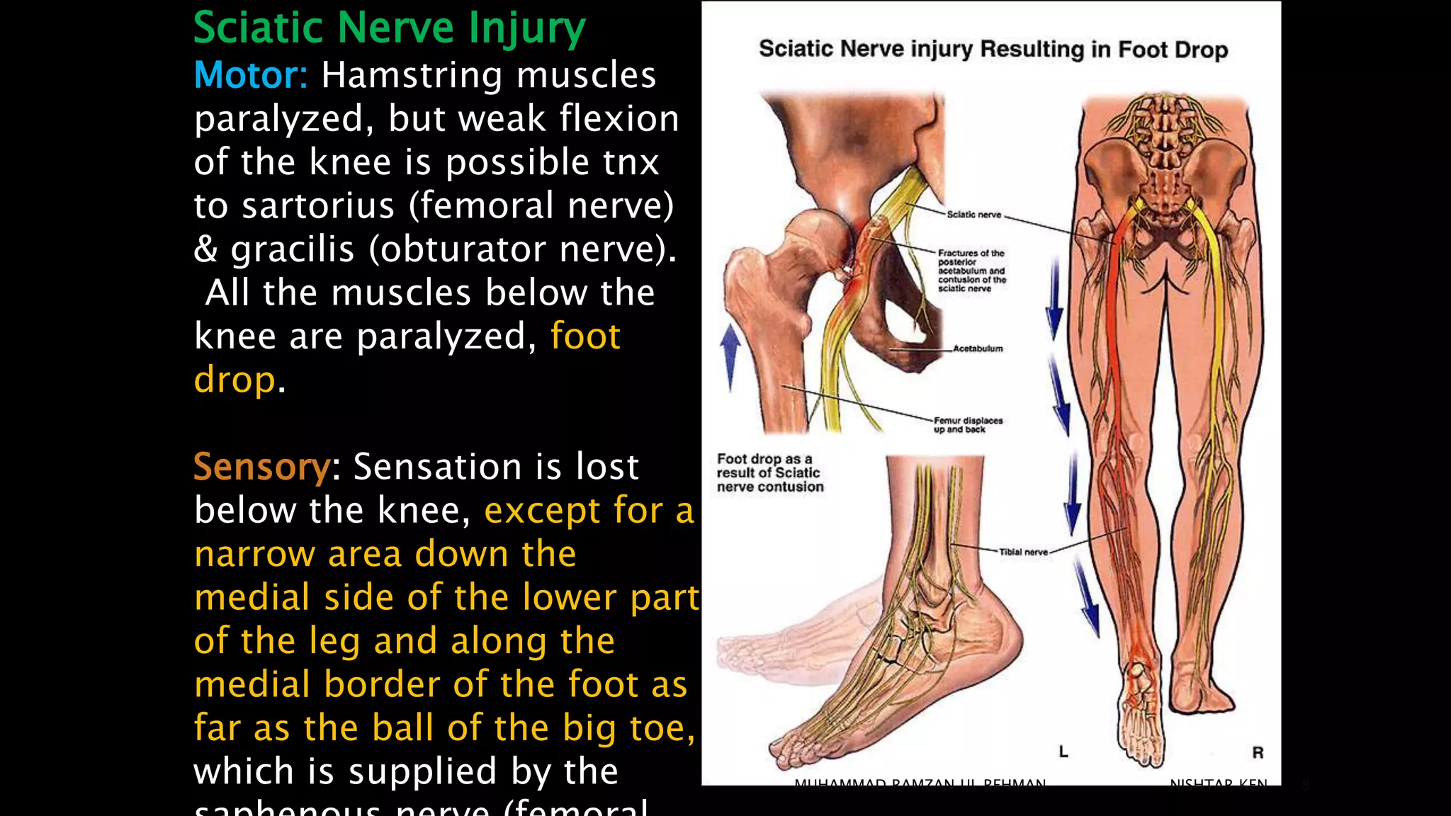 Clinical anatomy of the lower limb | PPTX