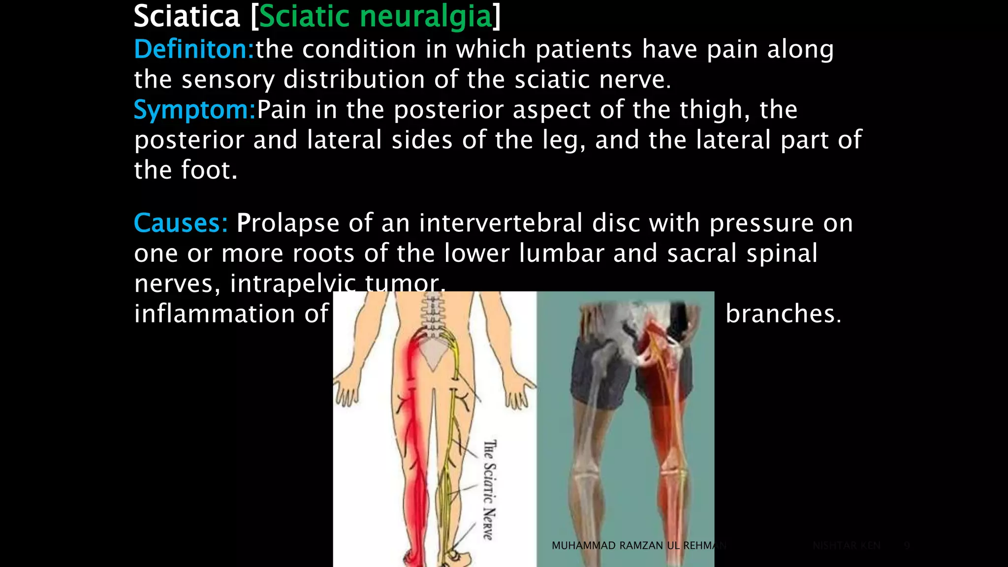 Clinical anatomy of the lower limb | PPTX