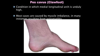 Clinical anatomy of the lower limb | PPTX