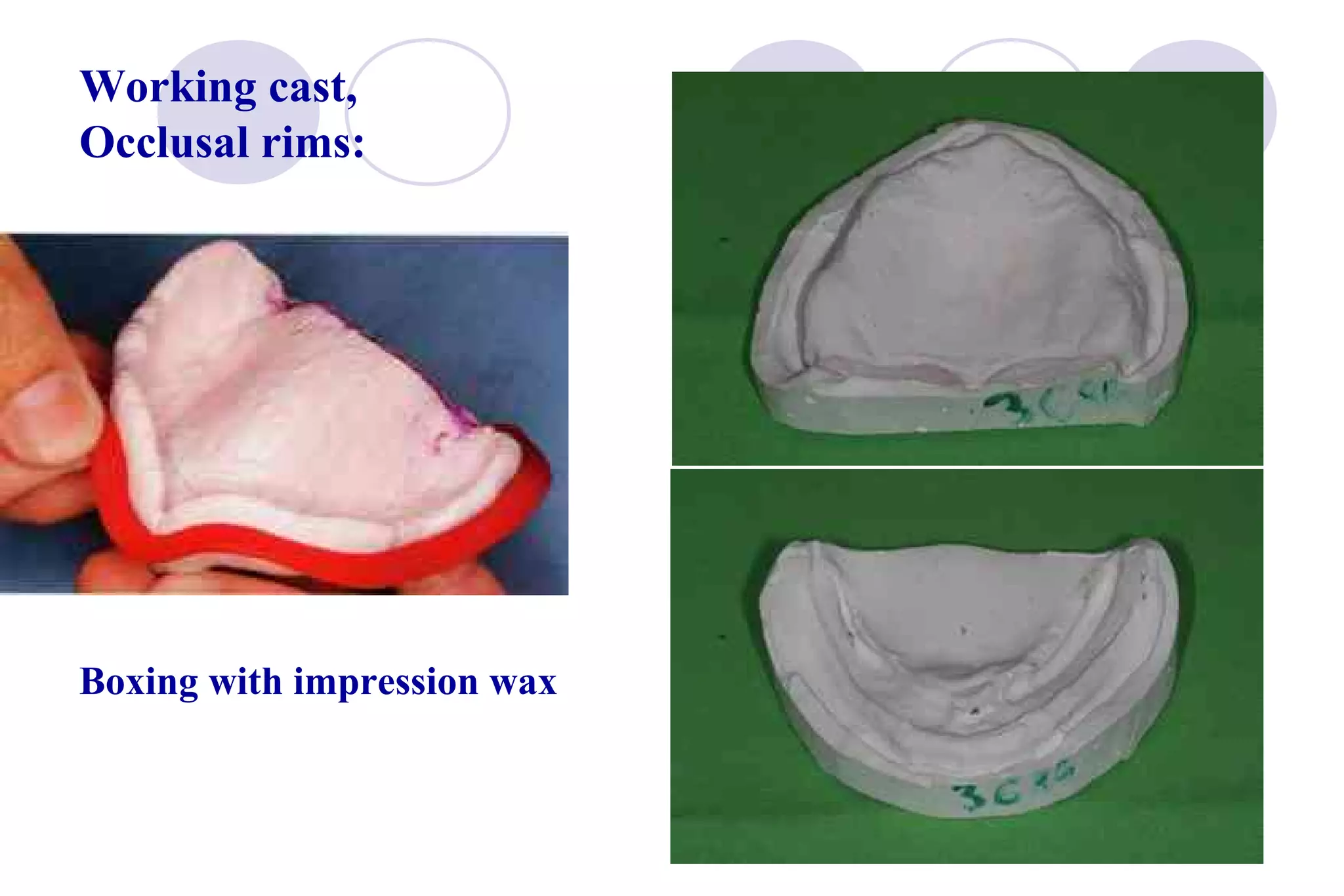 Clinical-and-laboratory-steps-of-Complete-denture.pdf