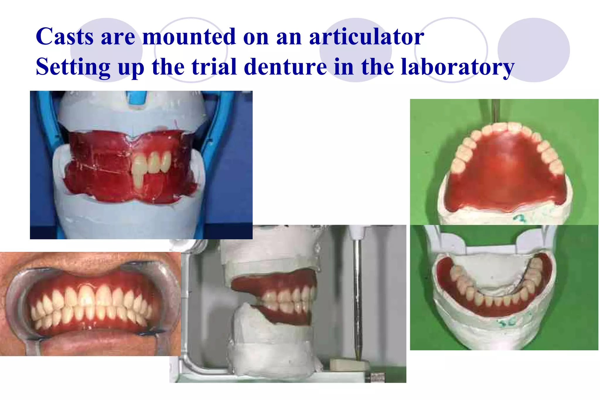 Clinical-and-laboratory-steps-of-Complete-denture.pdf