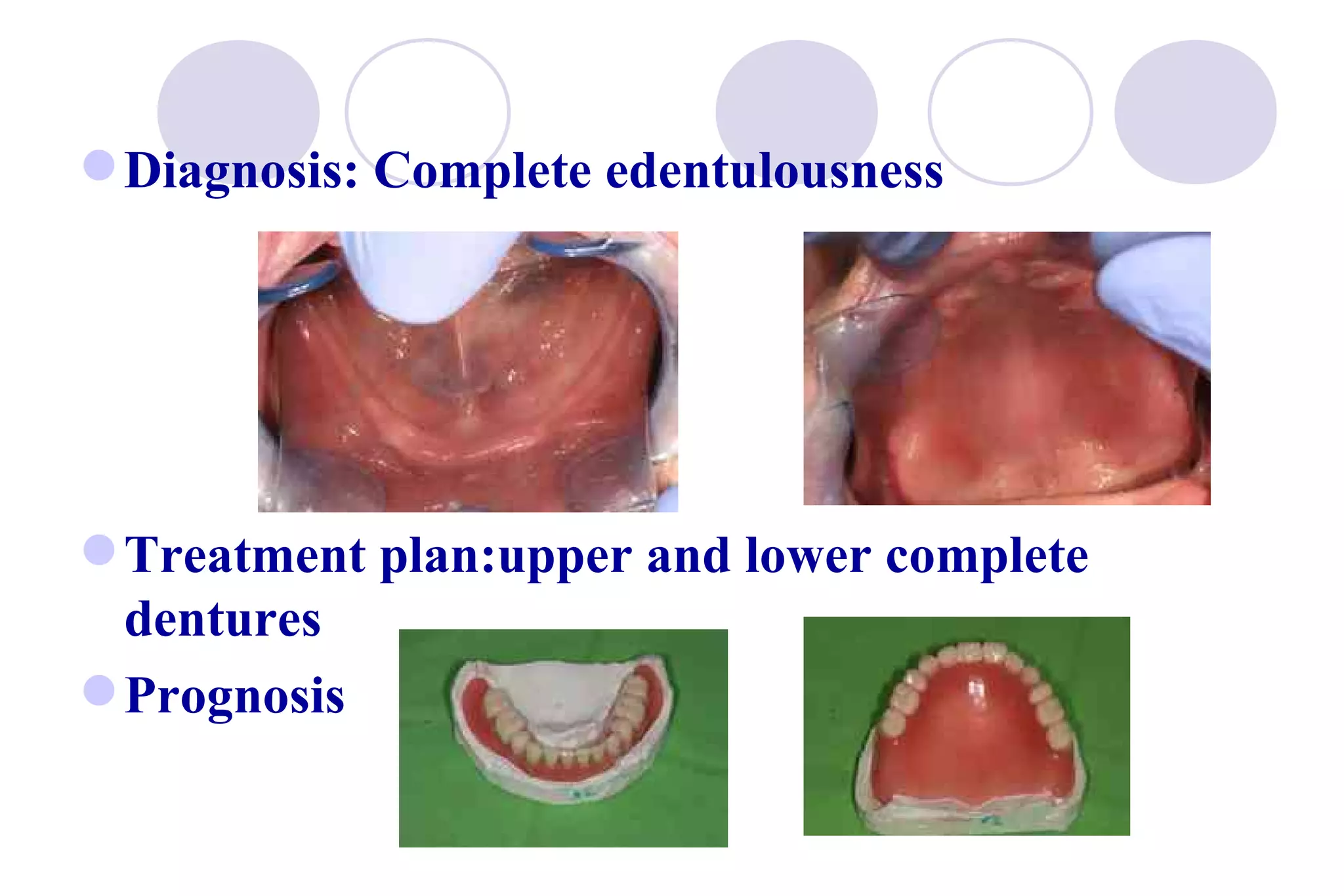 Clinical-and-laboratory-steps-of-Complete-denture.pdf