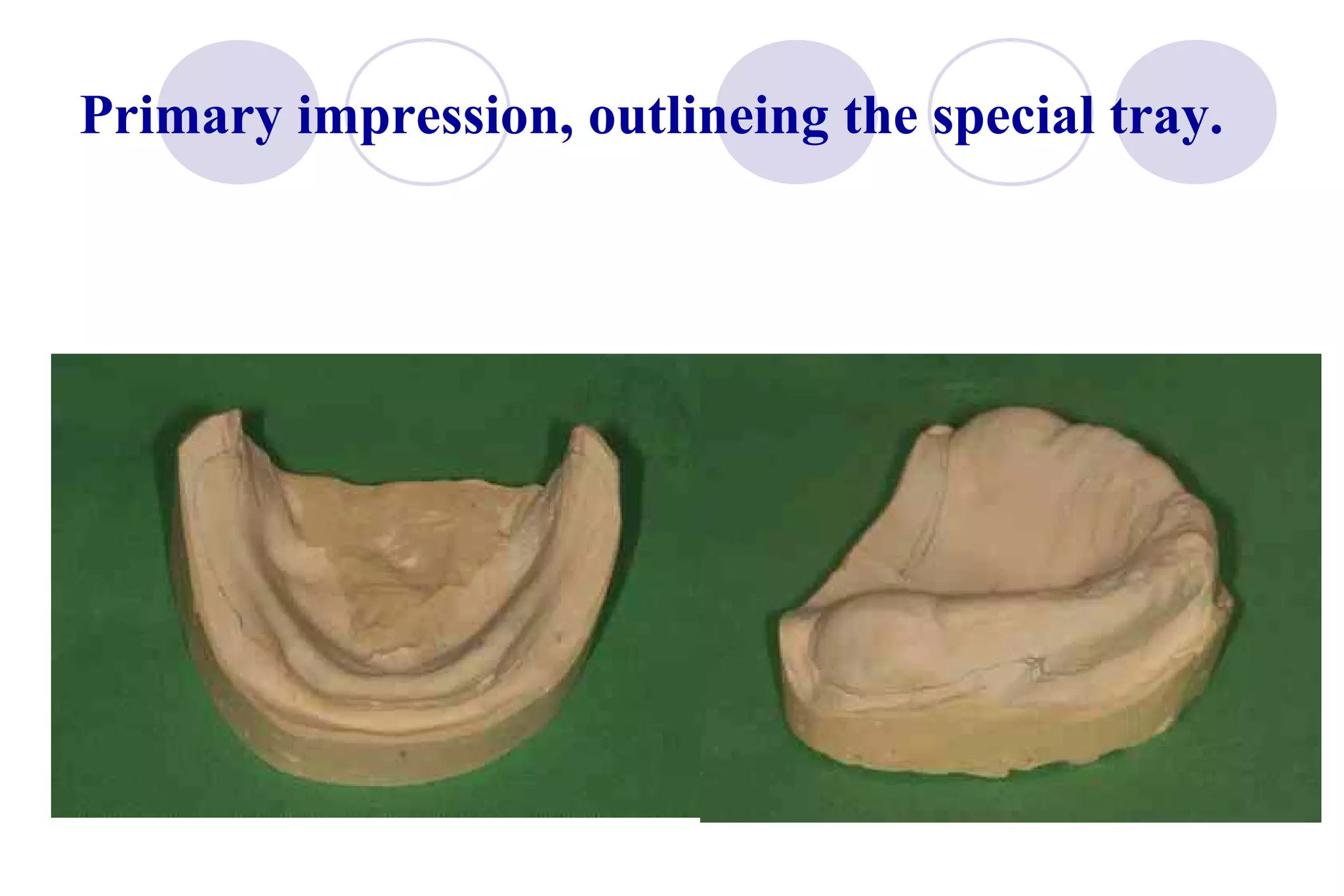 Clinical-and-laboratory-steps-of-Complete-denture.pdf | Dental Health ...