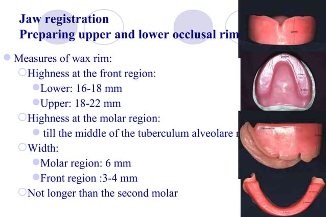 Clinical-and-laboratory-steps-of-Complete-denture.pdf | Dental Health ...