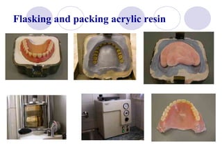Clinical-and-laboratory-steps-of-Complete-denture.pdf