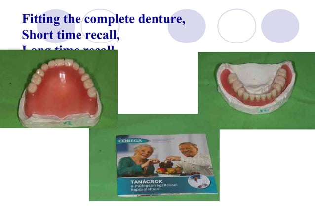 Clinical-and-laboratory-steps-of-Complete-denture.pdf | Dental Health ...