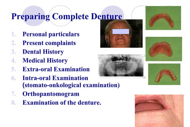 Clinical-and-laboratory-steps-of-Complete-denture.pdf | Dental Health ...