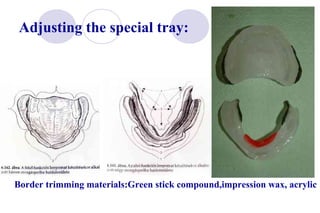 Clinical-and-laboratory-steps-of-Complete-denture.pdf