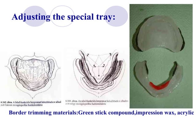 Clinical-and-laboratory-steps-of-Complete-denture.pdf | Dental Health ...