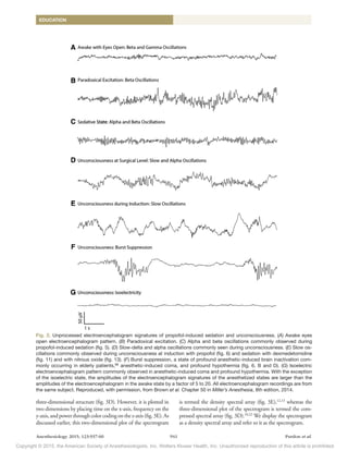 Clinical electroencephalography-for-anesthesiologists | PDF