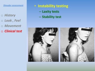 Clinical examination in shoulder disease | PDF