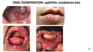 CLINICAL-EXAMINATION-MIGRNATS-AND-IDU.pptx | Infectious Diseases ...