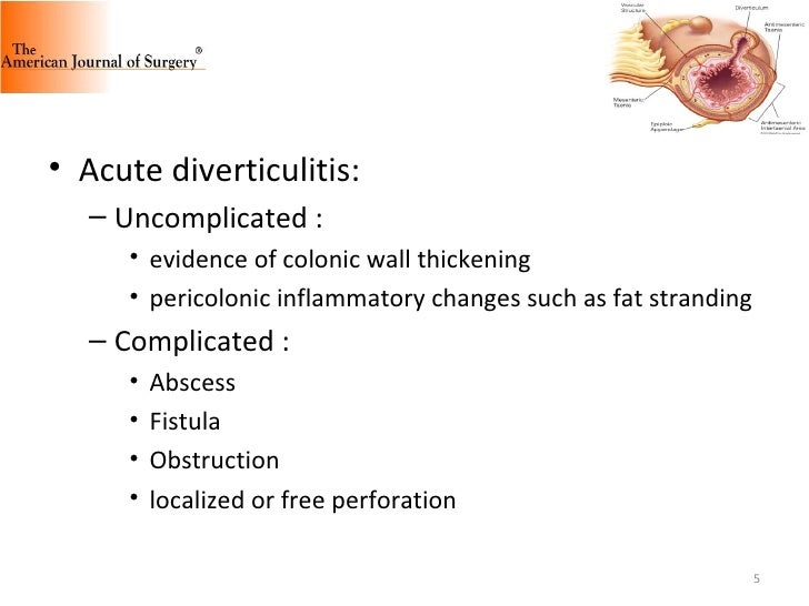 Clinical Outcomes Of Complicated Diverticulitis Managed Nonoperatively