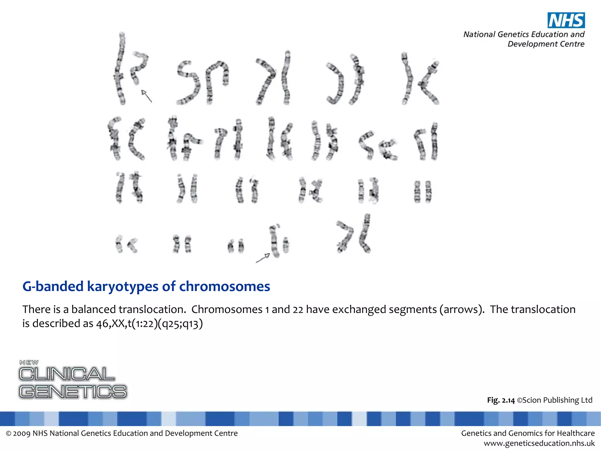 Clinical Photos - Chromosome structure abnormality | PPT