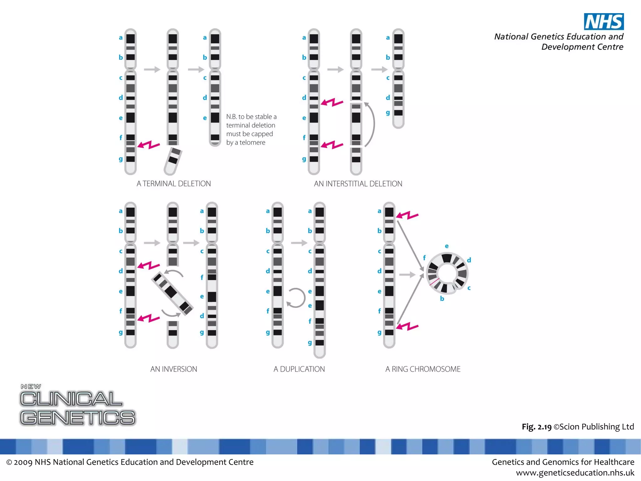 Clinical Photos - Chromosome structure abnormality | PPT