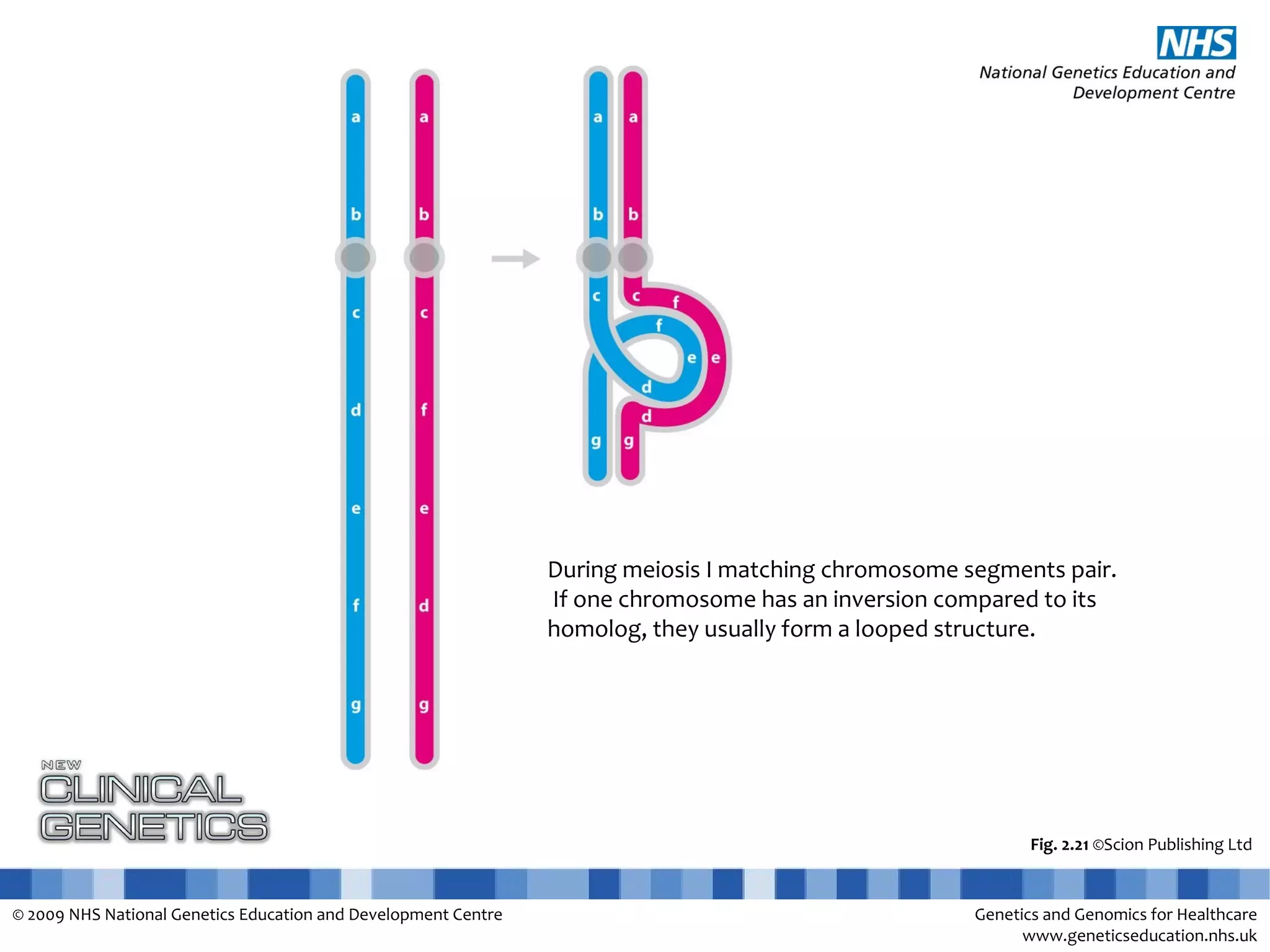 Clinical Photos - Chromosome structure abnormality | PPT