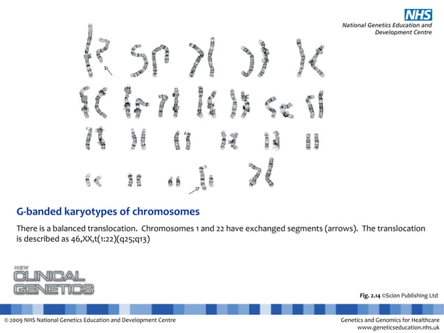 Clinical Photos - Chromosome structure abnormality | PPT