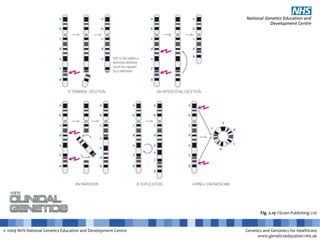 Clinical Photos - Chromosome structure abnormality | PPT