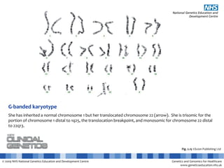 Clinical Photos - Chromosome structure abnormality | PPT