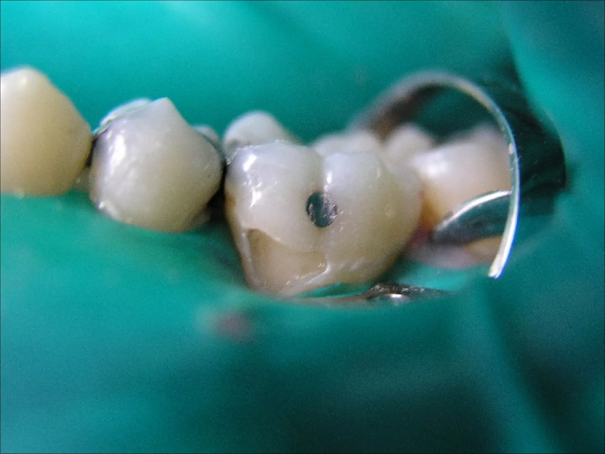 Clinical Photos | PPT