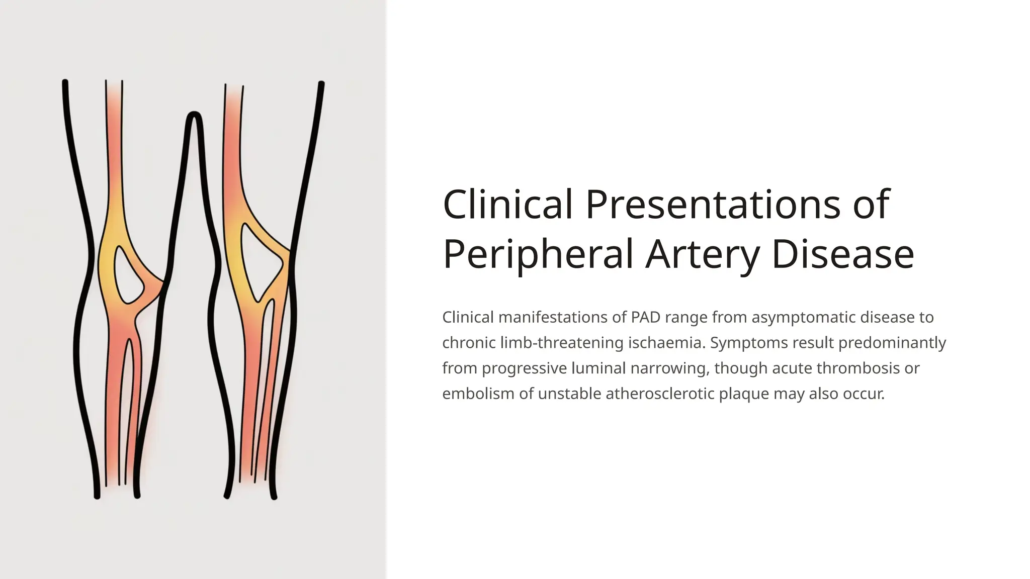 Clinical-Presentations-of-Peripheral-Artery-Disease.pptx