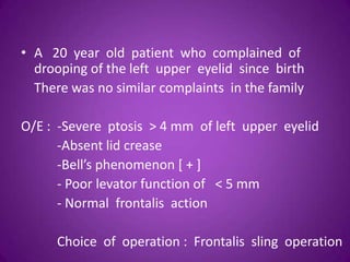 Clinical ptosis | PPTX